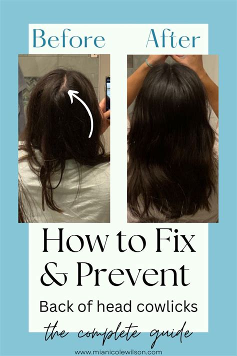 How To Get Rid Of Cowlicks In Hair Cowlick Hair Fixing Cowlick
