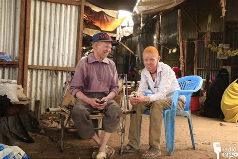 Albinos Face Attacks And Rejection In Somali Refugee Camps In Dadaab