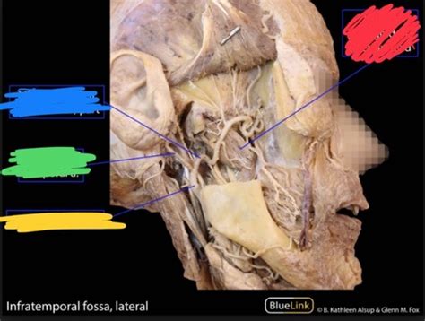 Infratemporal Fossa Cadaver Pics Flashcards Quizlet