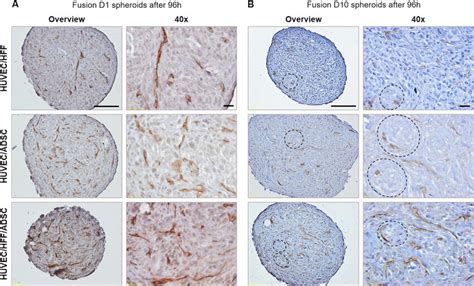 Capillary Like Network Formation In Fused Constructs Spheroids Were Download Scientific