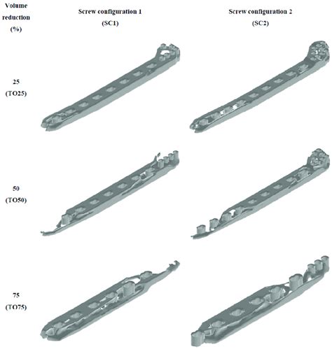 Topology Optimization Of A Custom Fit Distal Tibia Plate Under Two Download Scientific Diagram