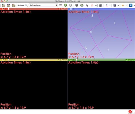 Documentation Modules CornerAnnotation Slicer Wiki