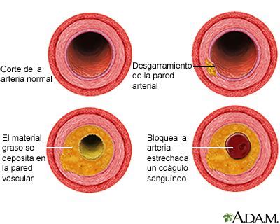 Descubre Cómo Cuidar Tu Corazón En La Tercera Edad Cambios Riesgos Y