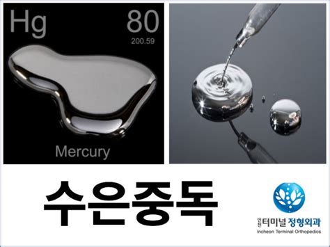 수은중독에 대하여 네이버 블로그