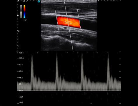 Sonoeye P1 Ultrasound Machine
