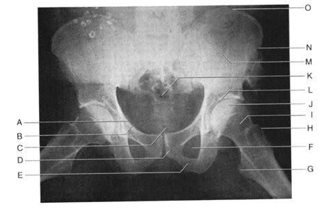 Anteroposterior Oblique Pelvis Projection Modified Cleaves Method Diagram Quizlet