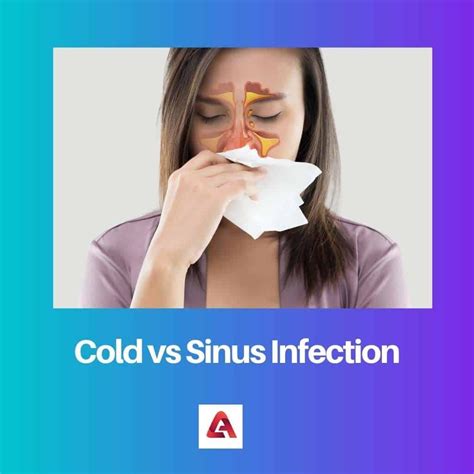 Cold Vs Sinus Infection Difference And Comparison
