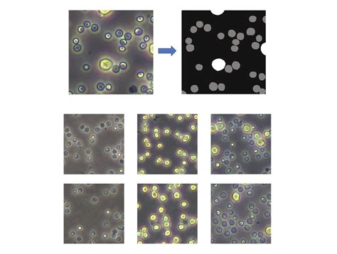 Researchers Found A New ML Method Capable Of Counting Cells For Disease Diagnosis Dataconomy