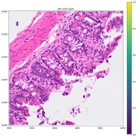 Technology Focus Visium Hd — Spatialdata Technology Focus Visium Hd — Spatialdata