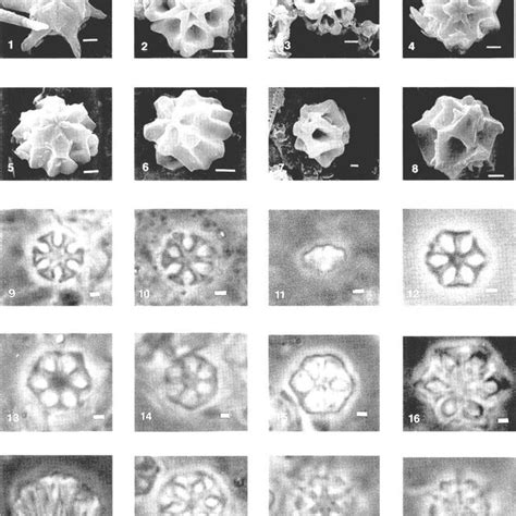 Are Sem Micrographs Figs 9 20 Are Phase Contrast Light Micrographs