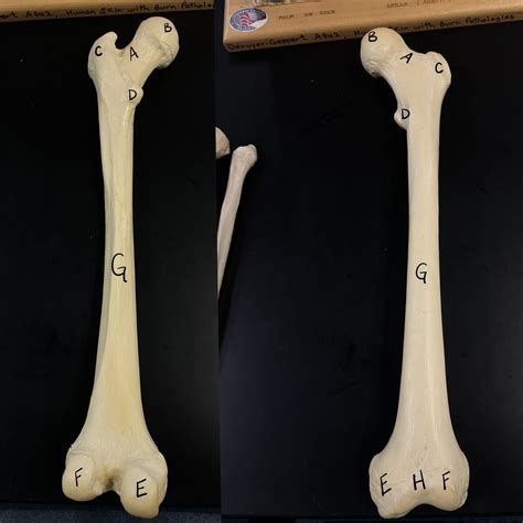 Left Femur Model Diagram Quizlet