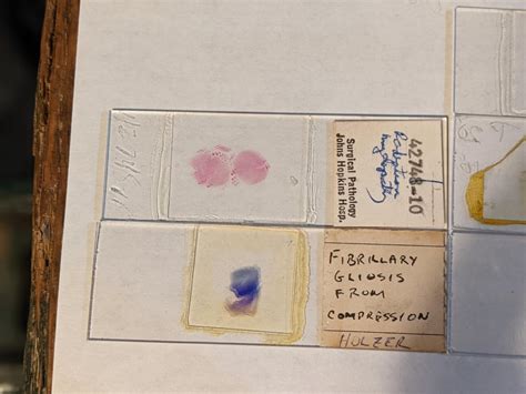 Small Collection Of Vintage Human Brain Sections Including Many