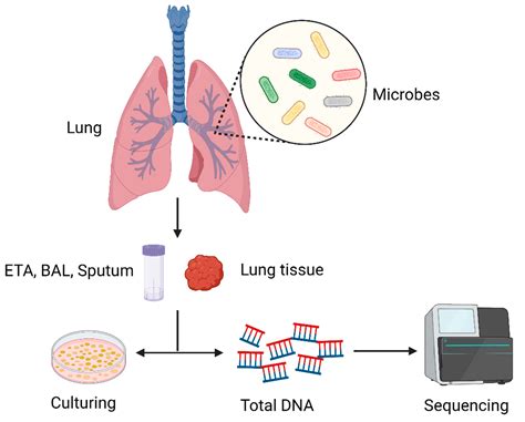 Humidifier Lung Bacteria At John Remaley Blog