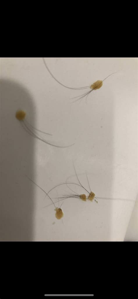 Is This Seb Derm Scalp Sebderm