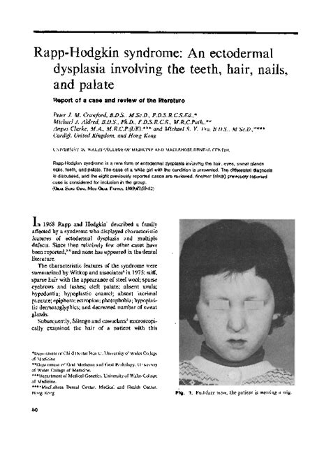 Pdf Rapp Hodgkin Syndrome An Ectodermal Dysplasia Involving The Teeth Hair Nails And Palate