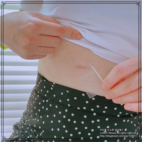 시카케어 밴드 수술 흉터 집에서 관리할 수 있어요 네이버 블로그