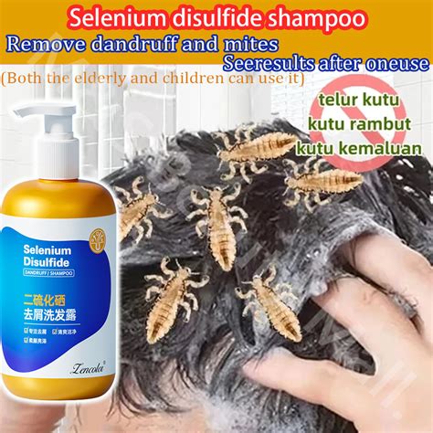 Selenium Disulfide Shampoo 300ml Strong Dandruff Shampoo Seborrheic Dermatitis Of The Scalp