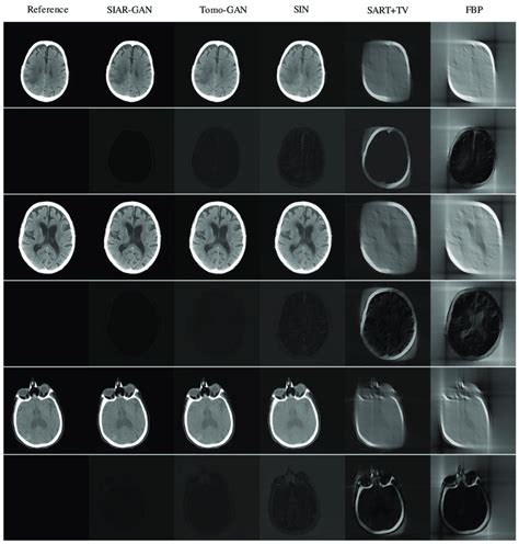 Reconstruction Results Of The Head Ct Data From The 90 Projection Data Download Scientific