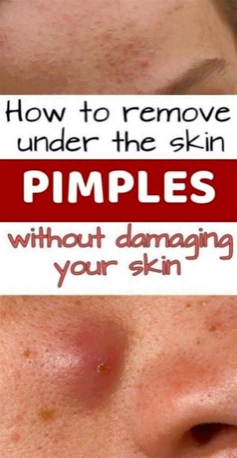 Do You Ve Got A Lump On Your Neck Back Or Behind Your Ear This Really Is What It Means