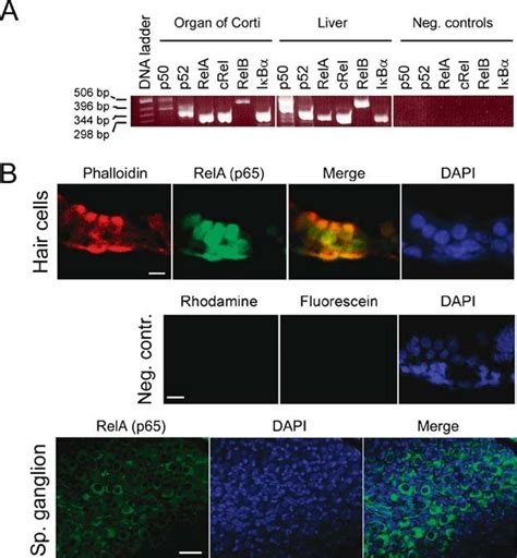Nf Kbrel Expression In The Cochlea A Rt Pcr Showing Expression Of Download Scientific