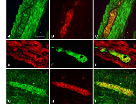 Immunohistochemical Double Labeling Of Rat Ileum Sections Myenteric Download Scientific