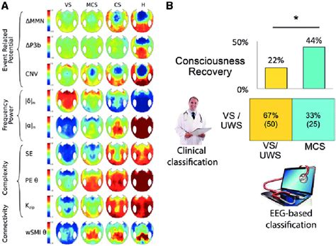 A Scalp Topography Of Markers Of Event Related Potentials Spectral