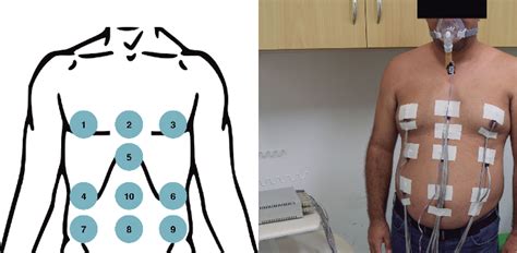 Figure 2 From Respiratory Waveform Estimation From Multiple Accelerometers An Optimal Sensor