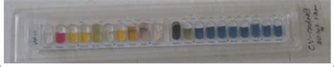 Api20e Biochemical Test Strip Identified The Bacterium As Download Scientific Diagram