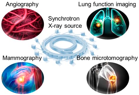 Application Of Synchrotron Radiation In Fundamental Research And Clinical Medicine
