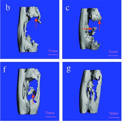 Three Dimensional Microct Reconstruction Of The Bone Regeneration In