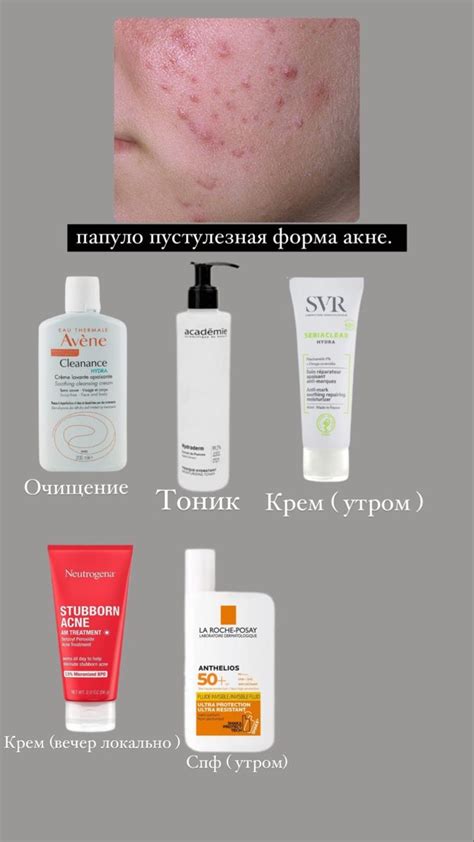 лечим прыщи Skin Cosmetics Face Products Skincare Face Skin Care Routine