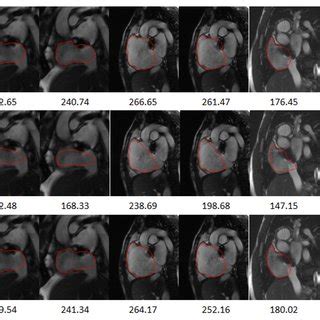 Segmentation Results Of Images From Test Dataset Download Scientific Diagram