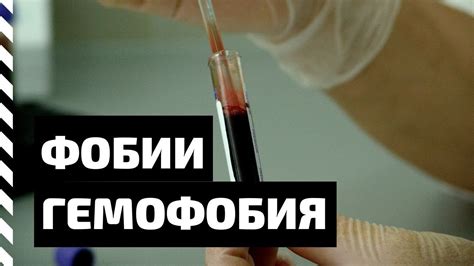 Фобия. Гемофобия — боязнь крови - YouTube