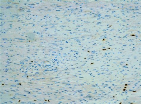 Ihc Analysis ×200 The Cellular Proliferation Index Ki67 Was