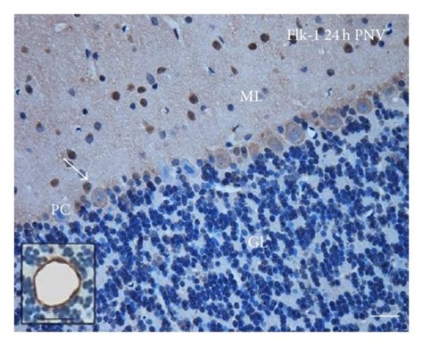 Photomicrographs Of Cerebellar Cortex Of Rats Aged 14 Days 5 Hours Download Scientific Diagram