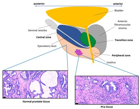 prostate anatomy representation of the prostate anatomy oriented in