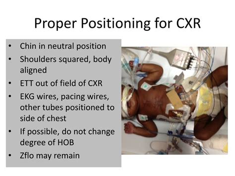 Ppt Proper Positioning For Cxr Powerpoint Presentation Free Download Id 2097247