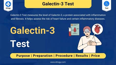 Typhidot Test Price Normal Range And Results Drlogy