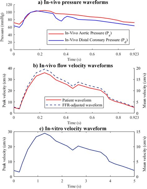 Hyperaemic Pressure And Velocity Waveforms Collected From A Patient Download Scientific Diagram