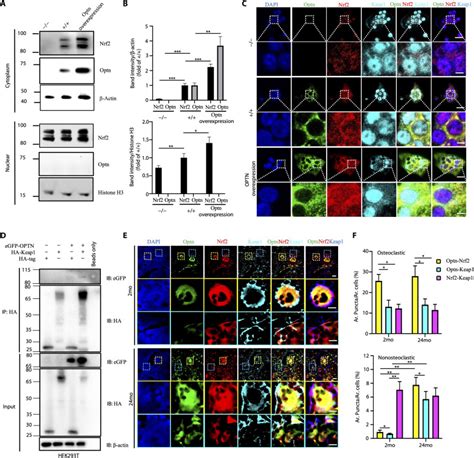 Optineurin Regulates Nrf2 Mediated Antioxidant Response In A Mouse