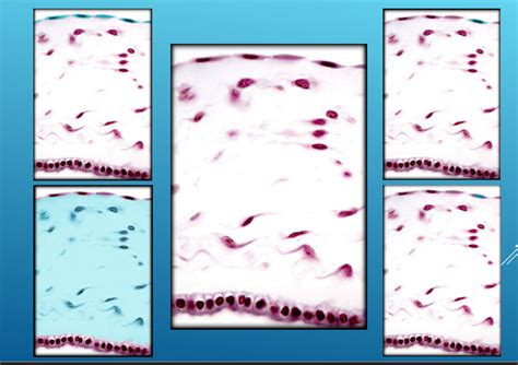 Simple Squamous Epithelium Diagram Quizlet