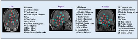 Landmarks For Patch Extraction Download Scientific Diagram