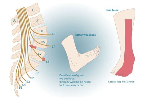 Best 13 Horizontal Section Through Lower Ends Of The Radius Ulna 3