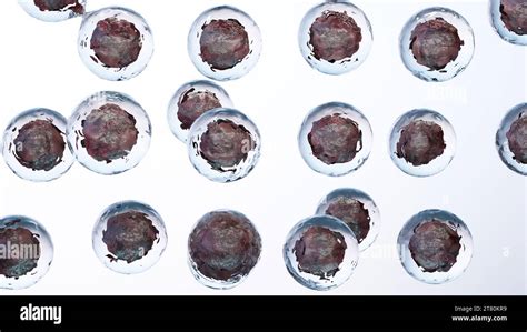 Cancer Cell Growth Uncontrollably Over Tissue Tumor Infection Cells
