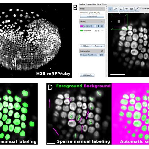 Labkit Allows Easy Manual Labeling And Automatic Segmentation Of Download Scientific Diagram
