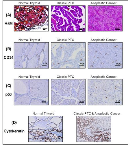 Hande And Immunohistochemistry Staining Of Thyroid Sections A Hande