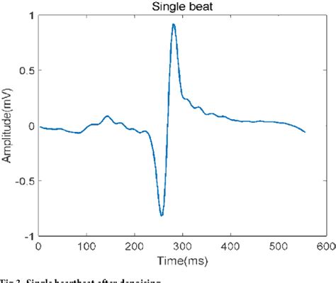 Figure 3 From Classification Of Ecg Signal Using Fft Based Improved