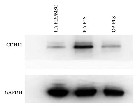 Effects Of Ucmsc On Cdh11 Expression By Fls From Ra Patients A C Download Scientific