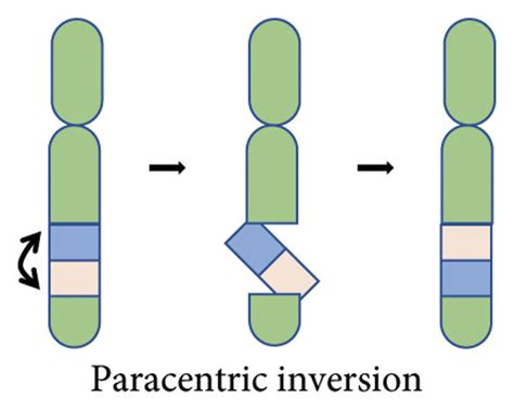 Chromosomal Inversions Two Breaks In The Same Chromosome Causing The Download Scientific