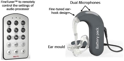Sonnet V R Eas Tm Audio Processor Image Courtesy Of Med El Download Scientific Diagram
